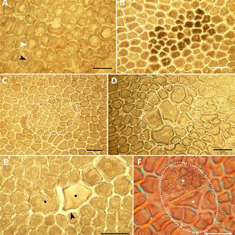 Examples Of Variability Of An Isolated Aleurone Layer A Surface View Download Scientific