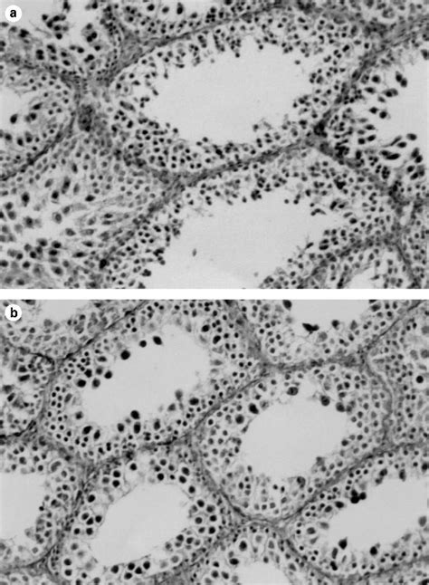 Figure 1 From Investigation On The Histopathological Effects Of