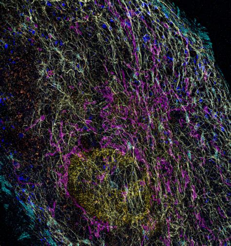 Multiplexing Archives Massive Photonics