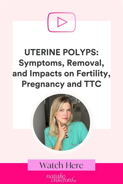 Uterine Polyps Artofit