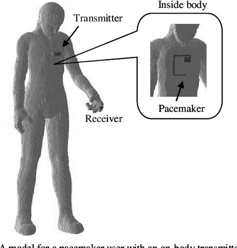 Figure 2 From Emc 09 Kyoto Emi Modeling For Cardiac Pacemaker In Human Body Communication