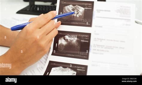 Gynecology Folliculometry Results Pregnancy Planning Dominant
