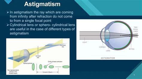 Different Aberration Related To Ophthalmic Lens Pptx
