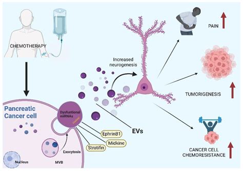 Cancers Free Full Text Perineural Invasion In Pancreatic Ductal