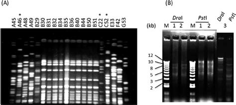 A Pfge Patterns Of Xba I Digested Chromosomal Dna Of Klebsiella