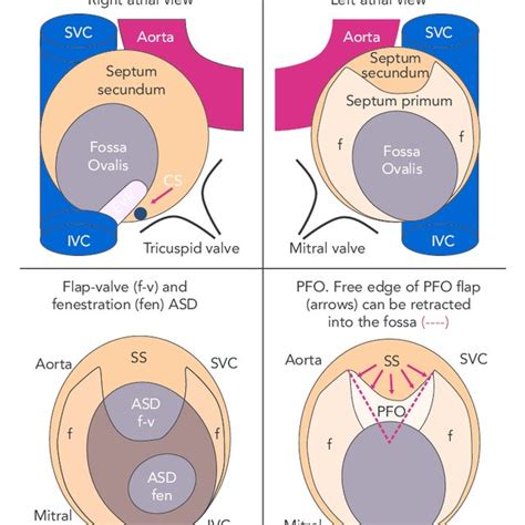 Pdf Pathophysiology And Management Of Arrhythmias Associated With