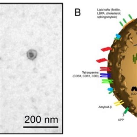 PDF Progress In Exosome Isolation Techniques