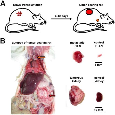 Presentation Of Renal Capsuleparathymic Lymph Node Complex 2a
