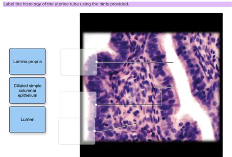 Solved Label The Histology Of The Uterine Tube Using The