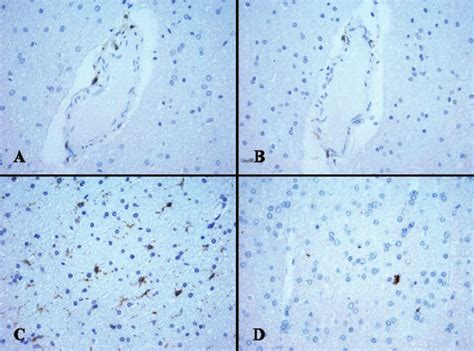 Normal Appearing White Matter The Cd3 Staining Shows Some T