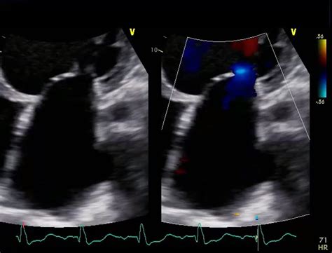 Falin Schaefer Posted On Linkedin