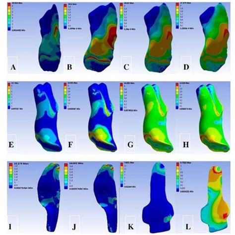 Trabecular Microfracture Follow Up Mri Data Download Table
