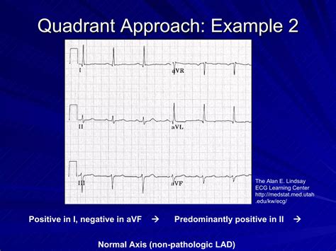 Ekg Basics LongCardiac Electrophysiology PPT