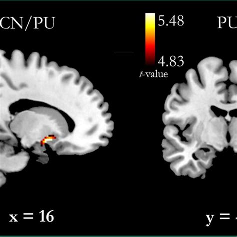 Reward Vs Loss Related Activations Greater Activation Was Observed Download Scientific