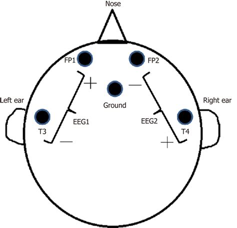 The Positions Of Five Electrodes On The Scalp Eeg Download