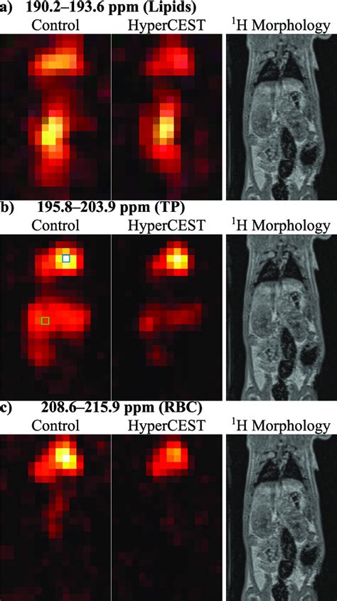 spectral maximum intensity projections of magnitude csi data along with
