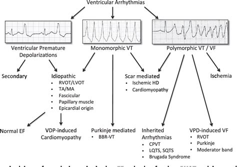 Figure 5 From Ablation Of Ventricular Arrhythmias Semantic Scholar