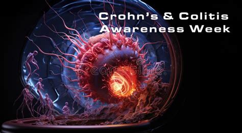 Crohns And Colitis Awareness Week Stock Illustration Illustration Of Foster White 299016760