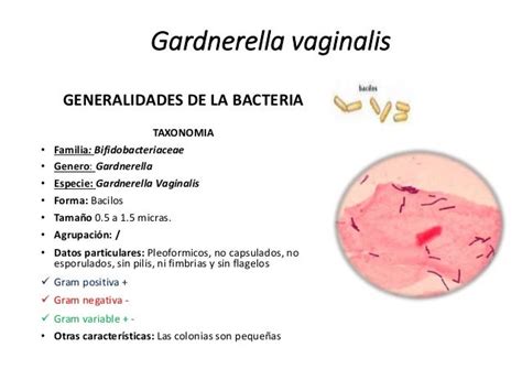 Gardnerella Vaginalis