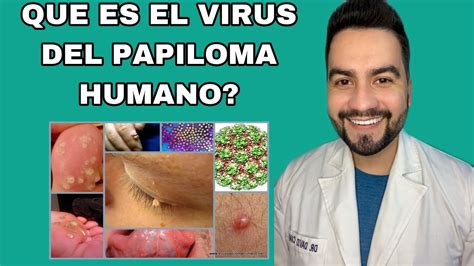 El Virus Del Papiloma Humano Vph Que Es Cómo Se Contagia Y Sus