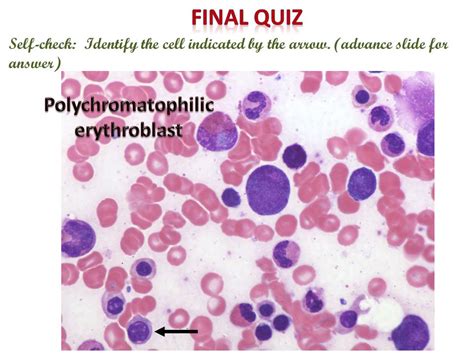 Polychromatophilic Erythroblast