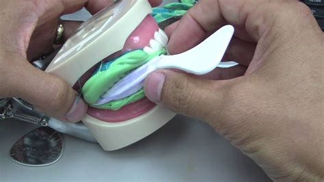 Impression Material For Crown And Bridge At Francis Needham Blog