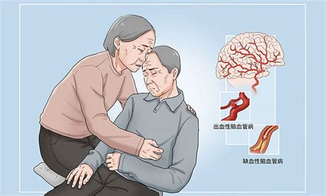 脑供血不足 上海蓝十字脑科医院官网 同济大学附属脑科医院筹