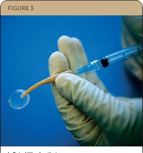 Vaginal Abscess Drainage