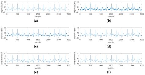 applied sciences free full text an ecg signal de noising approach based on wavelet energy