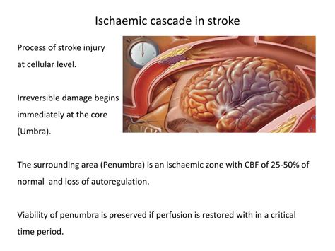 Ppt Stroke Acute Care And Thrombolysis Adrian Pace Neurology Spr