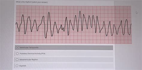 What Is The Rhythm Select Your Answer StudyX