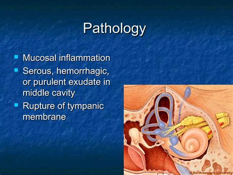 Acute Otitis Media And Mastoiditis Ppt