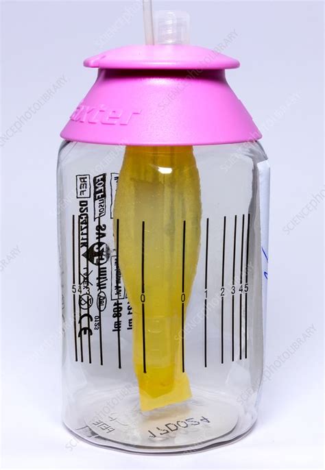 Elastomeric Pump For Ambulatory Infusion Stock Image C0369730 Science Photo Library