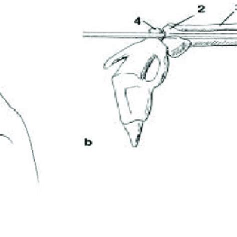 Intraosseous Administration Download Scientific Diagram