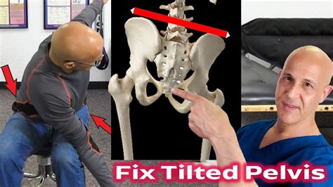 Fix Uneven Pelvis And Hips In 60 Seconds Dr Mandell Youtube Pelvis Stretching Hip Stretches