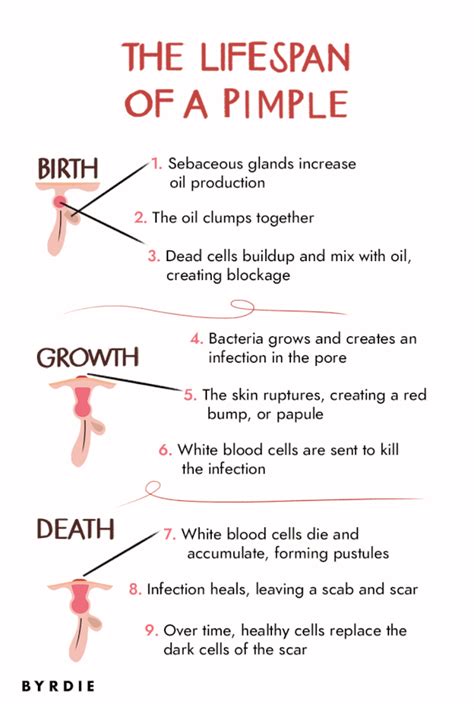 Pimples How Do They Form And How Long Do They Last