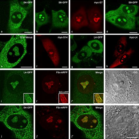 Figure 1 From Intranucleolar Sites Of Ribosome Biogenesis Defined By