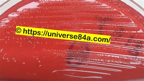 Enterococcus Faecalis Introduction Morphology Pathogenicity Lab