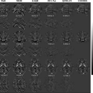 Comparison Of QSM Of Test Subject 1 Reconstructed Using Download Scientific Diagram