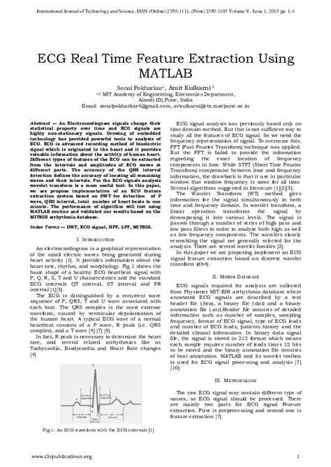 pdf ecg real time feature extraction using matlab
