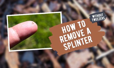 Hacks On How To Remove A Splinter Without Using Tweezers