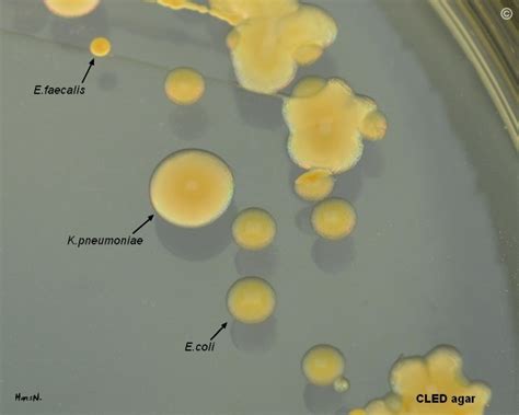 Klebsiella Pneumoniae Enterococcus Faecalis And Escherichia Coli On