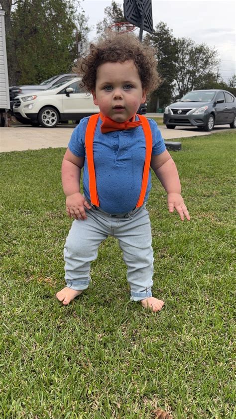 Jacob Jacobs Journey With Juvenile Systemic Scleroderma