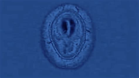 Brain Scan Visualization Footage The Device Scans And Displays Vital Signs On The Screen