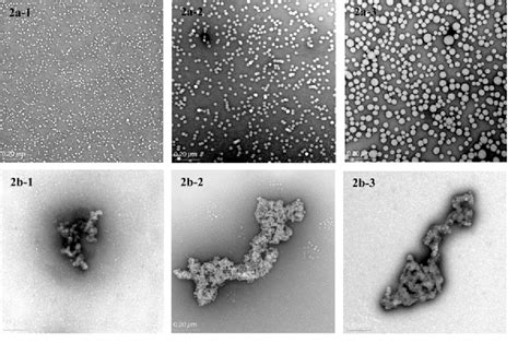 Figure 2 From Dynamic Reaction In A Homogeneous Hdl Cholesterol Assay Visualized By Electron