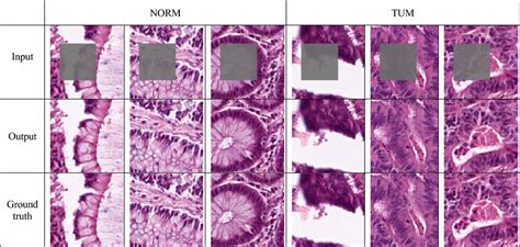 Restoration Results For Colon Pathological Images The Top Row Is