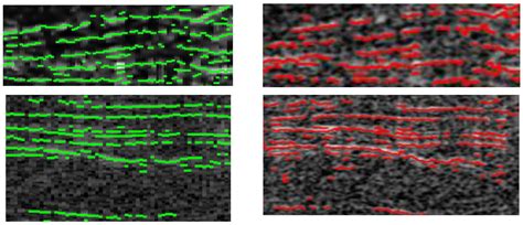 Automatic Extraction Of Martian Subsurface Layer From Radargrams Based On Pde Denoising And Kl