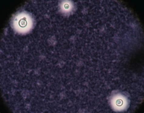 India Ink Staining Principle Procedure And Results Microbial Notes