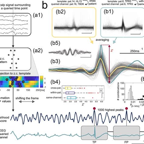 Generalization Of Template Based Intracranial Ied Detection A