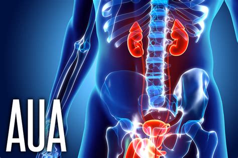 Guideline Clarifies Work Up For Microhematuria Medpage Today